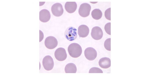 Paludisme à Plasmodium knowlesi : un nouveau danger pour l’homme