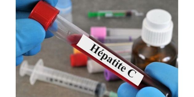 L’efficience du dépistage universel du VHC non démontrée selon la HAS